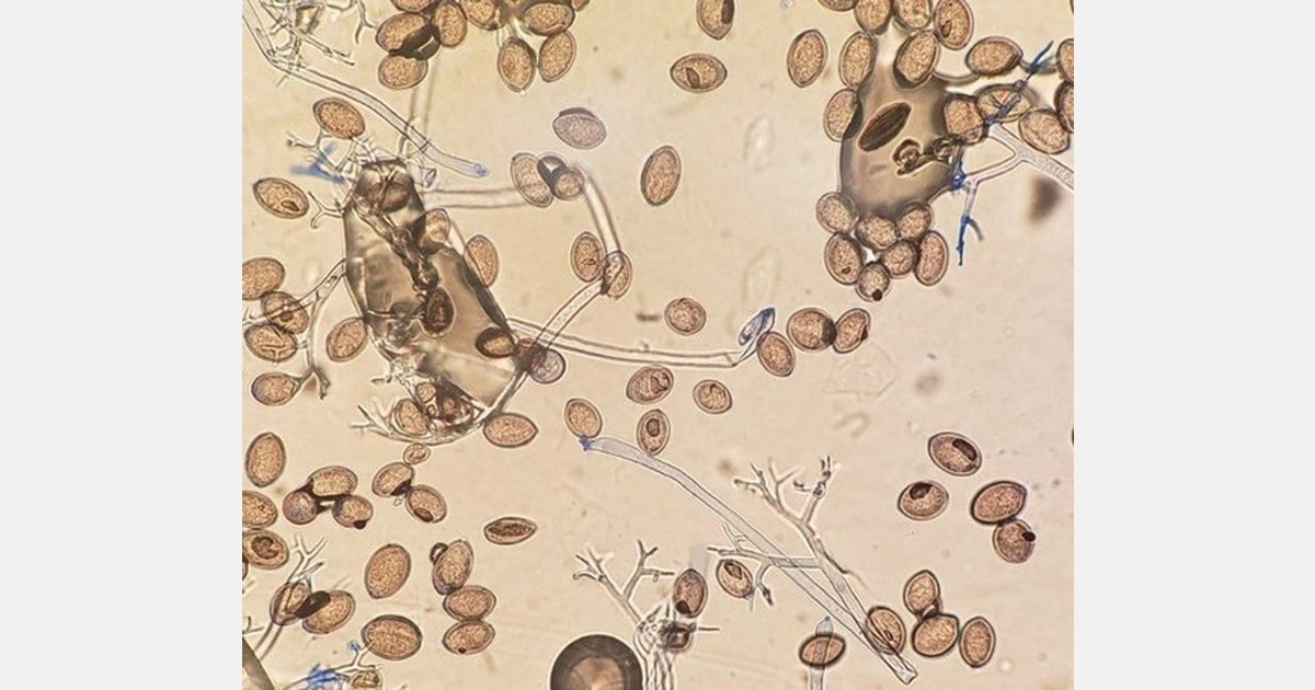 US (MI): First cucurbit downy mildew spores identified in air samples ...