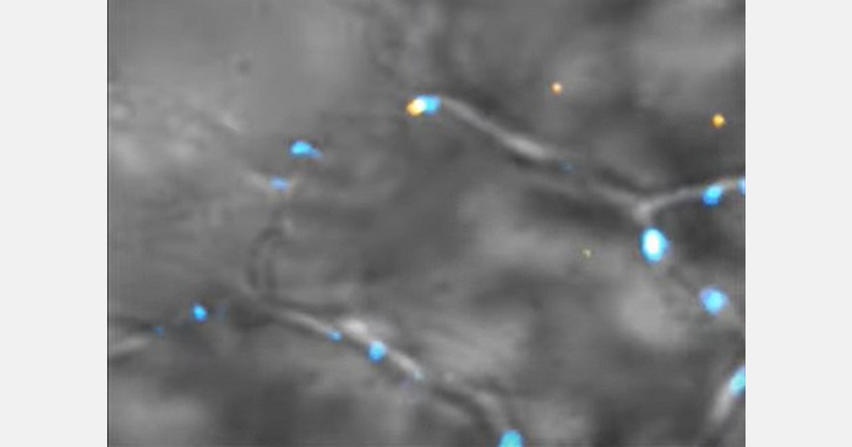 See how plants communicate by "passing notes"