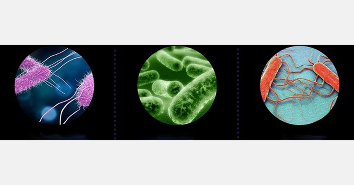 New virus detection technology to curb the spread of plant-born ...