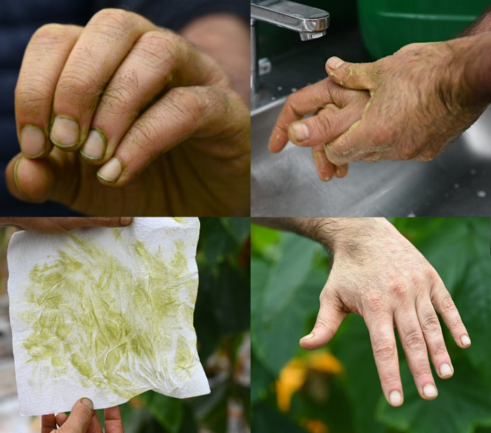 The importance of hand hygiene in battling rugose