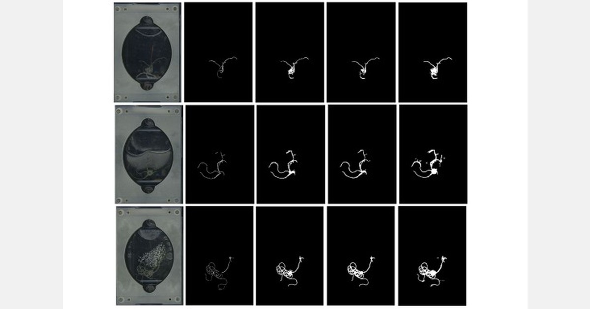AI-driven plant root analysis
