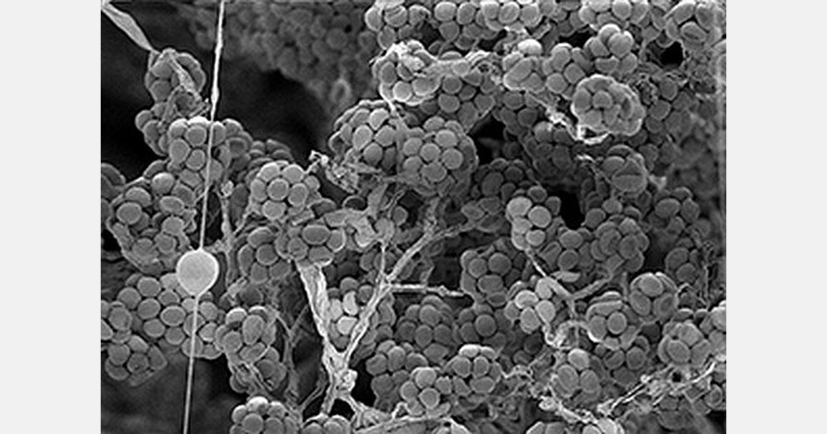 Belgium, Netherlands and France welcome Asperello T34 Biocontrol